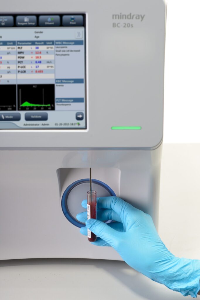 Tanish MediQuip | BC-20s Hematology Analyzer – Reliable 3-Part ...